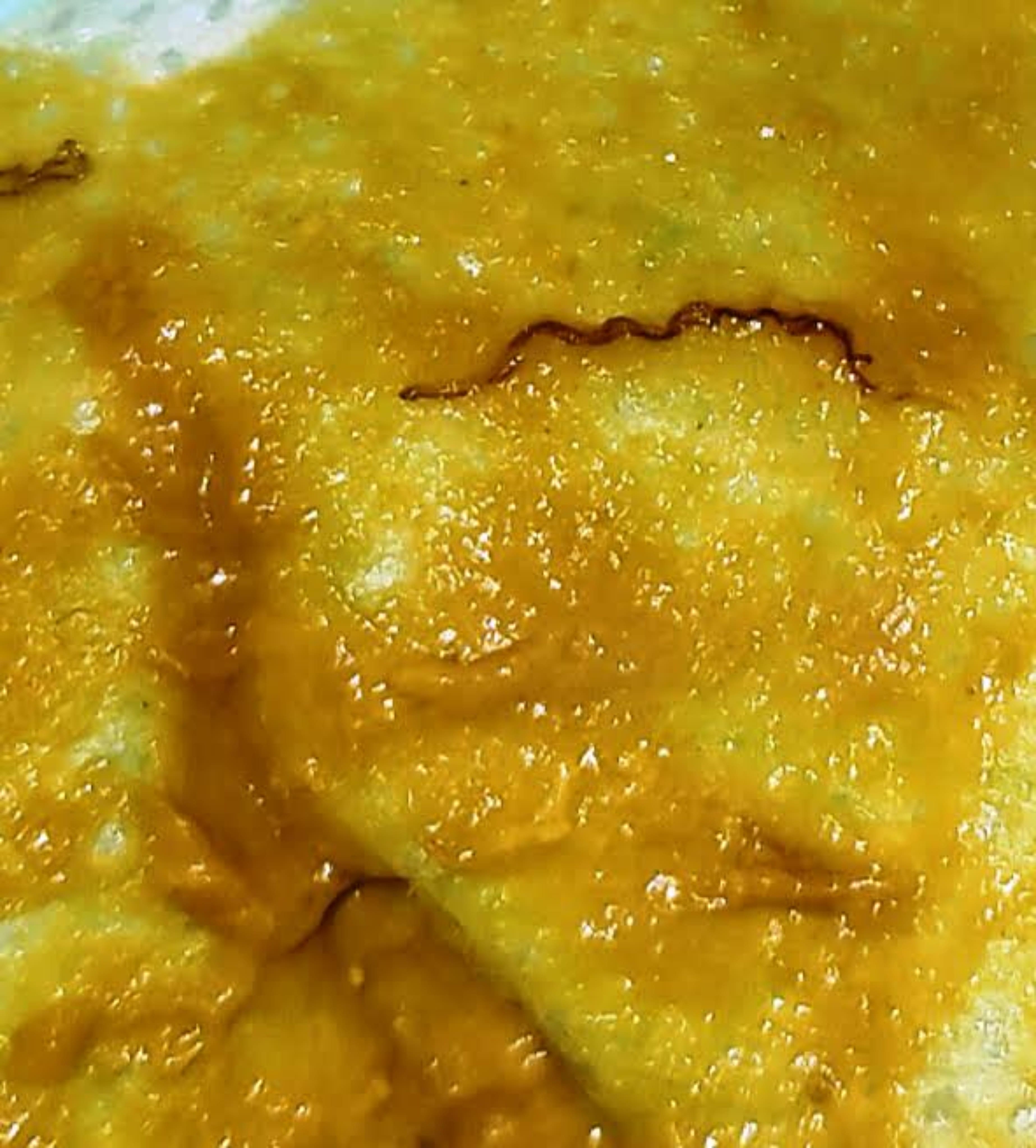 Pinworms In Toddler Poop