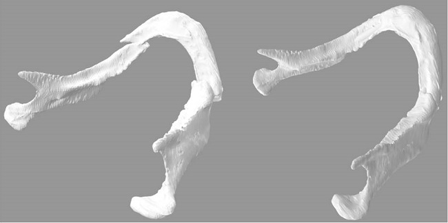 Nota técnica: planificación virtual 3D en el tratamiento de fractura ...