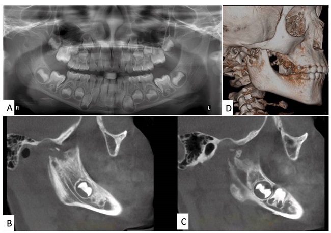Histologia De Celulas De Langerhans Célula De Langerhans Wikipedia,