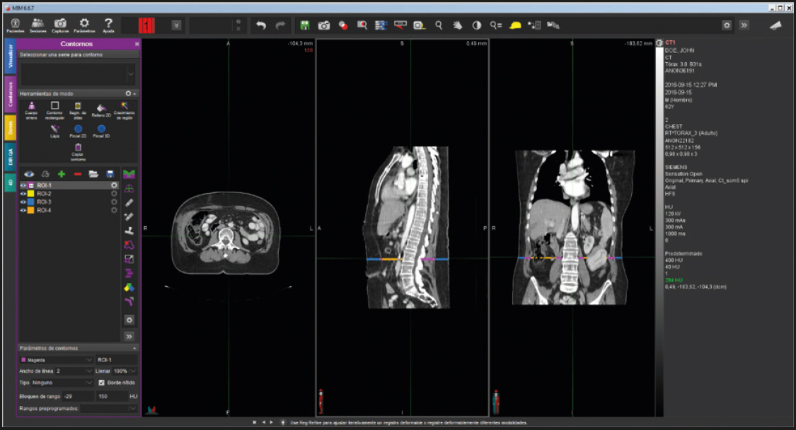 Measurement of body composition in cancer patients using CT planning ...