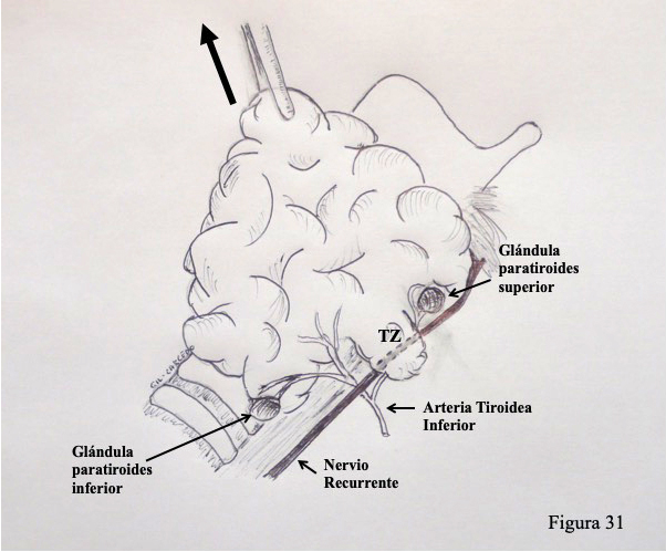 Anatomía quirúrgica de las glándulas tiroides y paratiroides