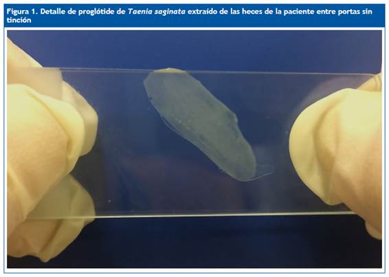 Heces Humanas Con Tenia