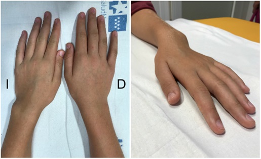 Deformidad articular no traumática en paciente adolescente