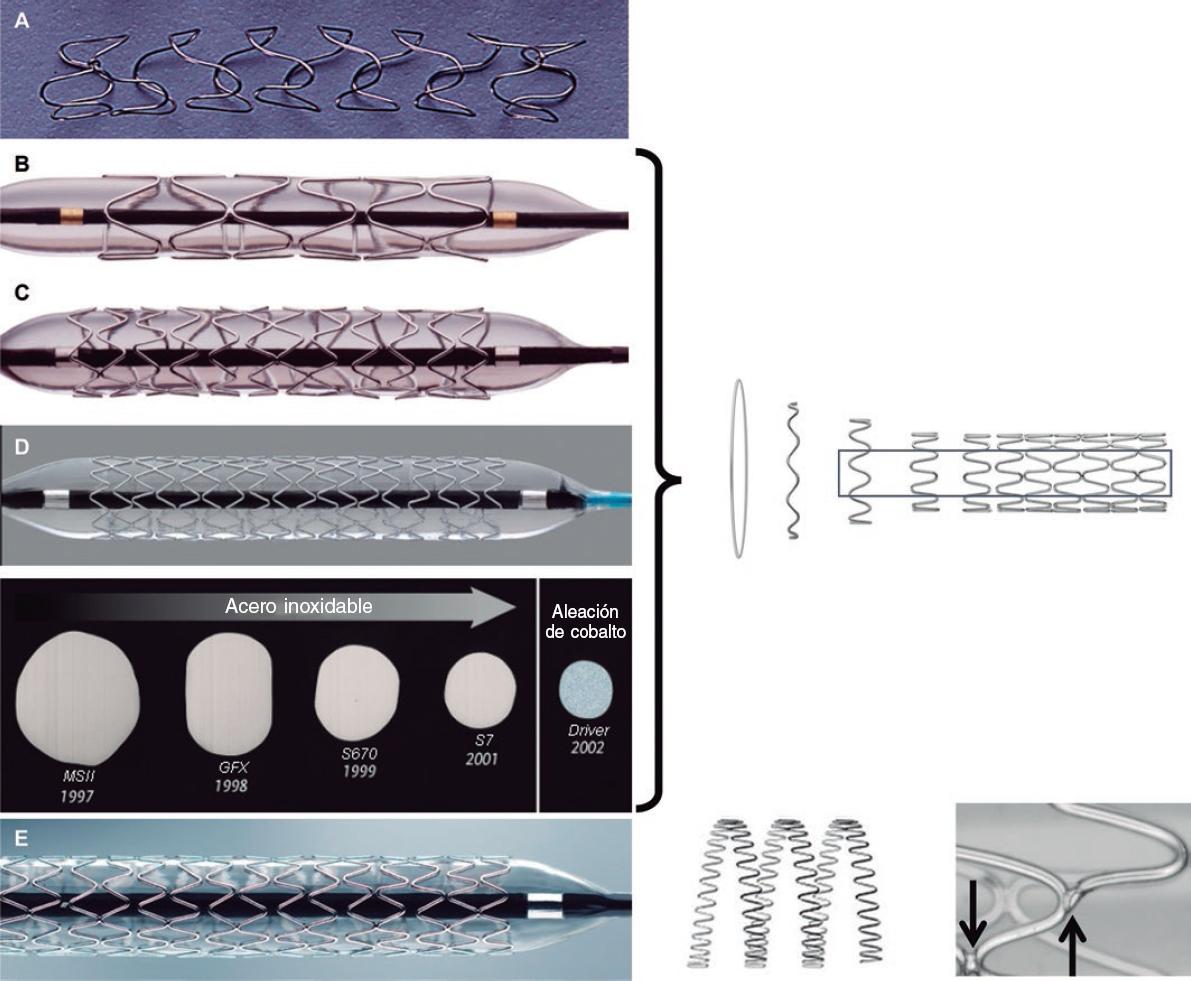 Origen del stent coronario: una historia de éxito entre científicos ...
